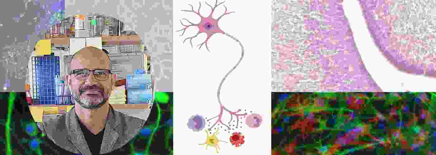 Neuroimmune Interactions Lab Neuroimmune Interactions Lab